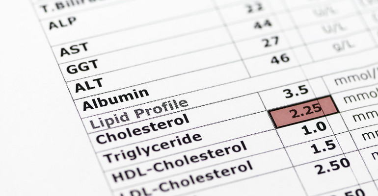 Triglicerydy - wskazania do badania, normy. Co oznacza wysoki i niski ...