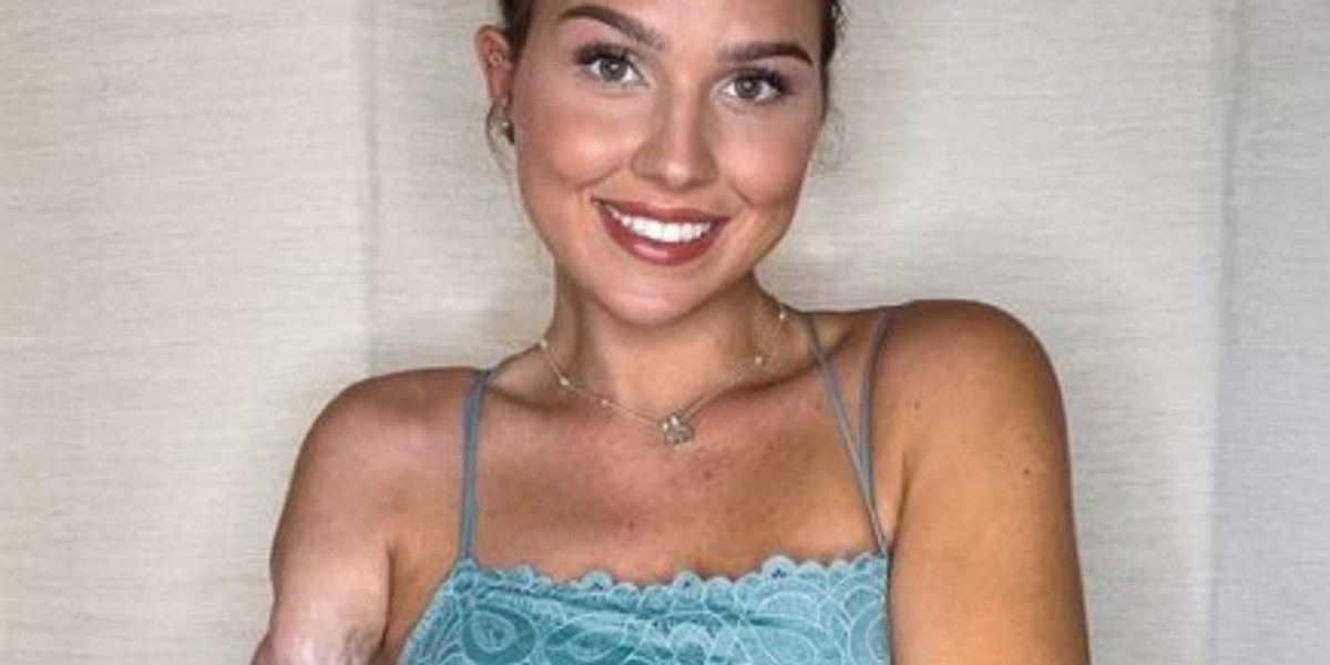 Gina Rühl mogłaby zostać nową Miss Niemiec — tylko z jedną ręką - Kobieta