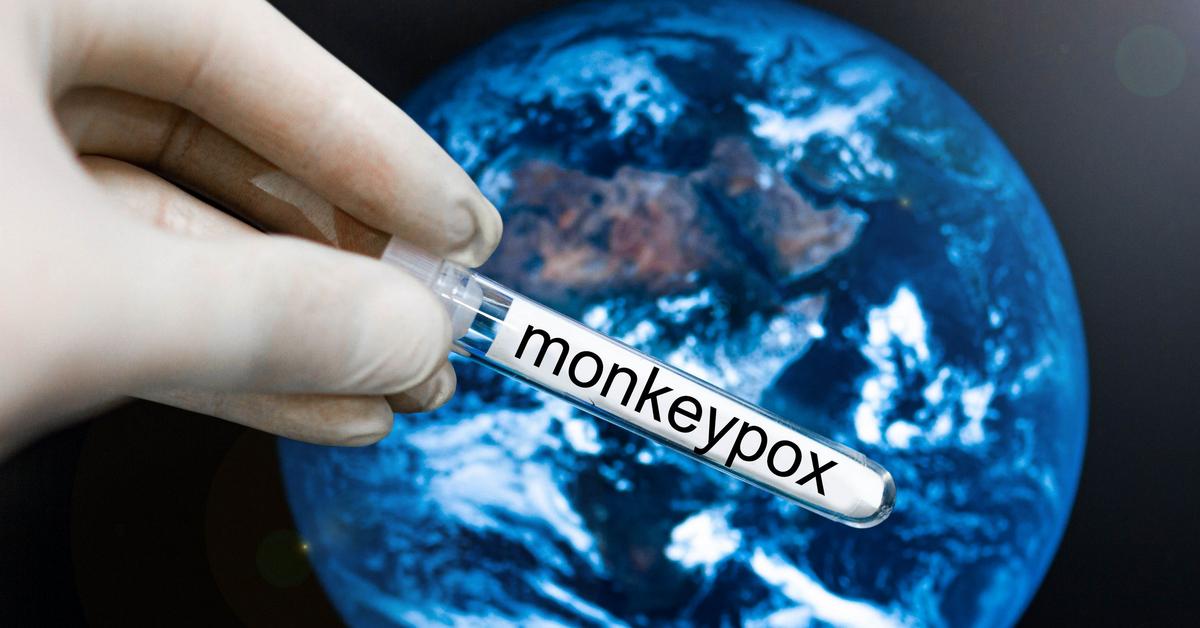 WHO: Ponad 1000 przypadków małpiej ospy poza endemicznymi krajami ...