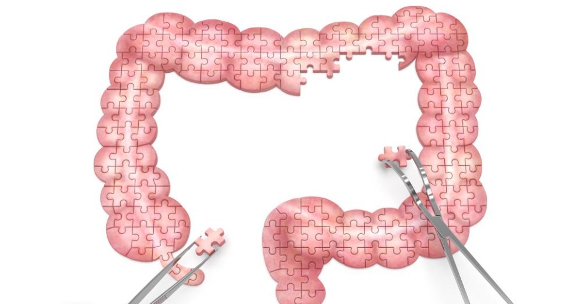 Jelito aż nadto drażliwe