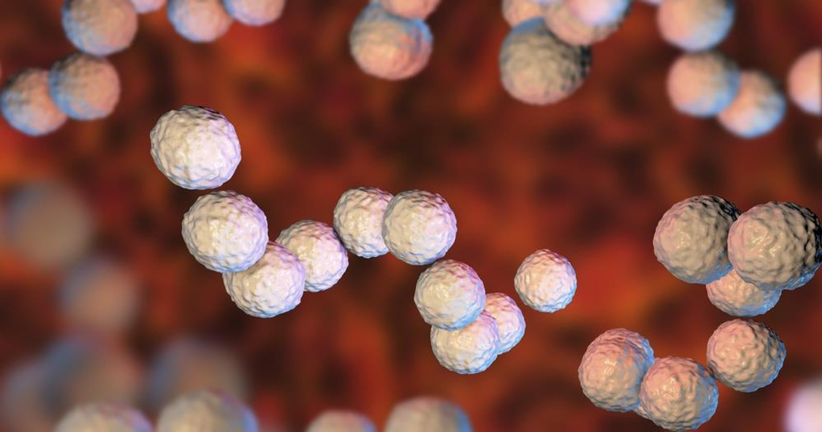 Angina Plauta i Vincenta - przyczyny, objawy, rozpoznanie i leczenie