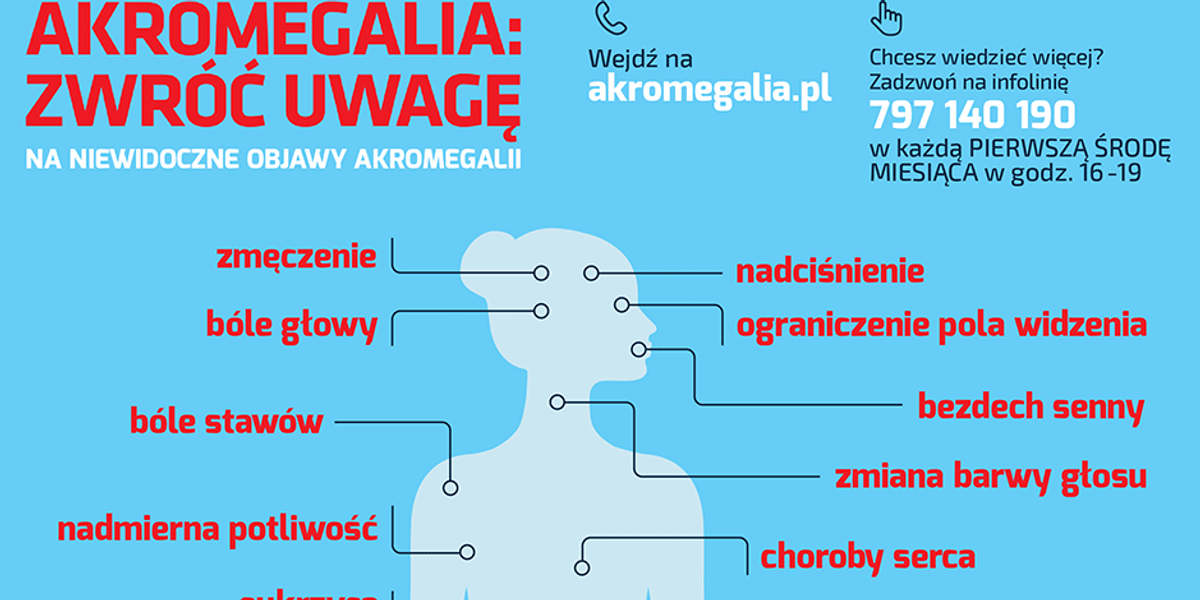 Akromegalia: jak rozpoznać chorobę? - Wiadomości