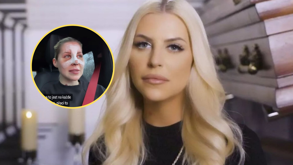 Julia von Stein przeszła operację i zawiodła się na bliskich. "Nagle nikogo nie ma!" - Plejada.pl