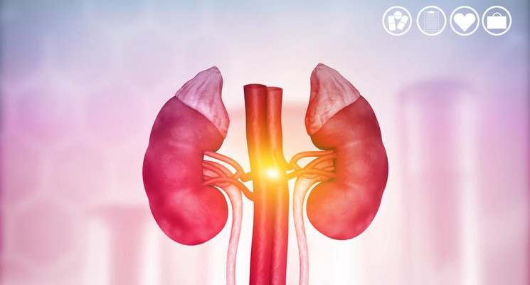 Zapalenie nerek - rodzaje, objawy, leczenie