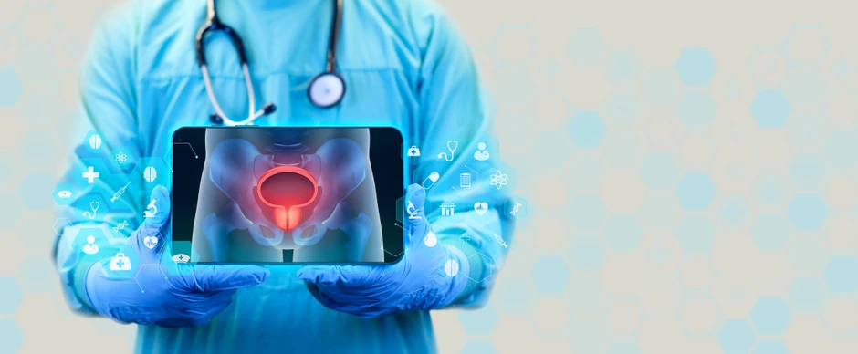 Razvoj raka prostate u početnoj fazi može da se spreči: Tri namirnice ...