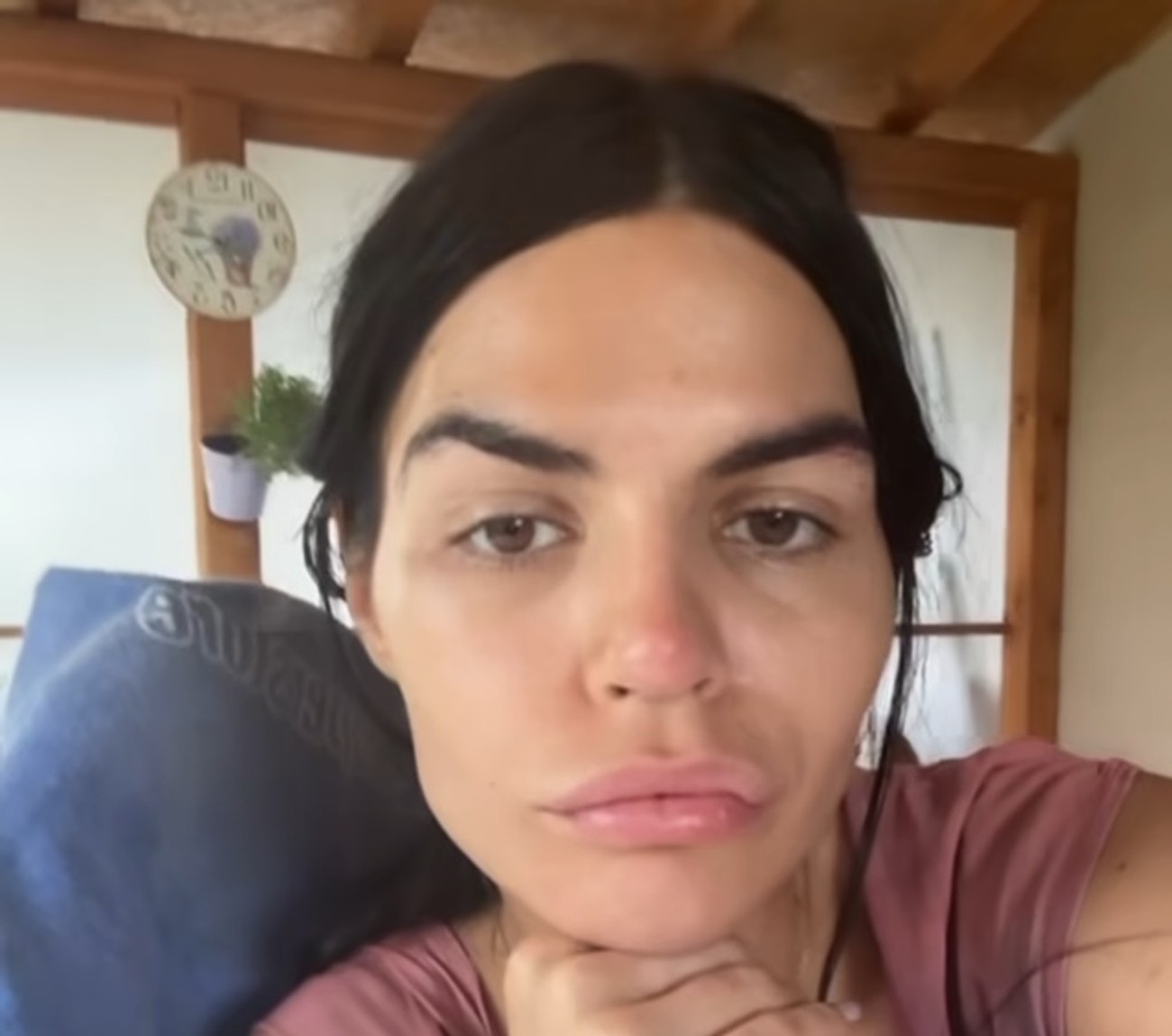 Dejana Zivković pre operacija: Sada vratila prirodan izgled a ovako je ...