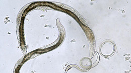 Glista ludzka - objawy zakażenia. Jak leczyć glistnicę?