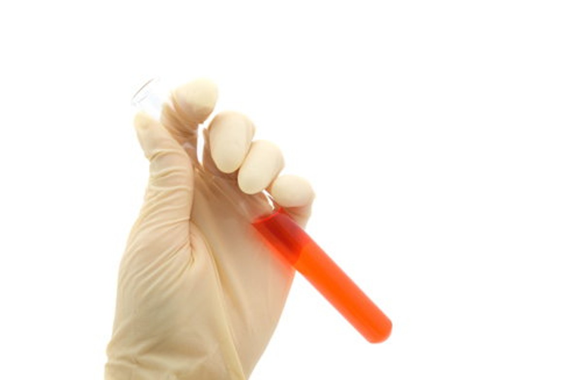 Šta govori boja vaše mokraće