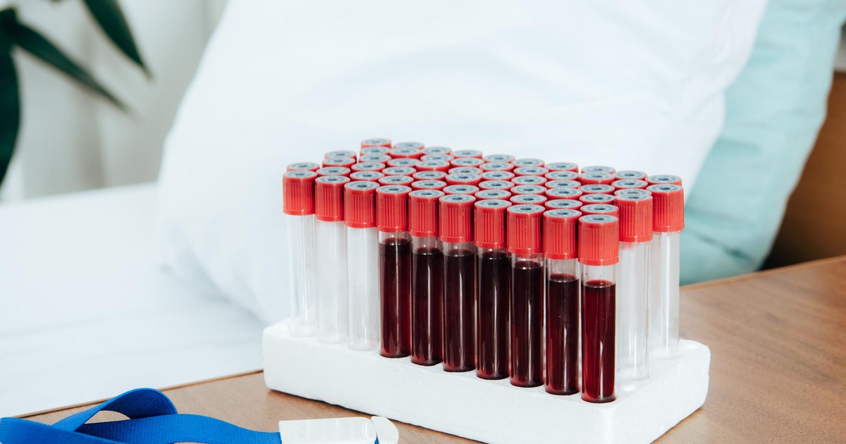 Gamma-glutamylotranspeptydaza (GGTP)