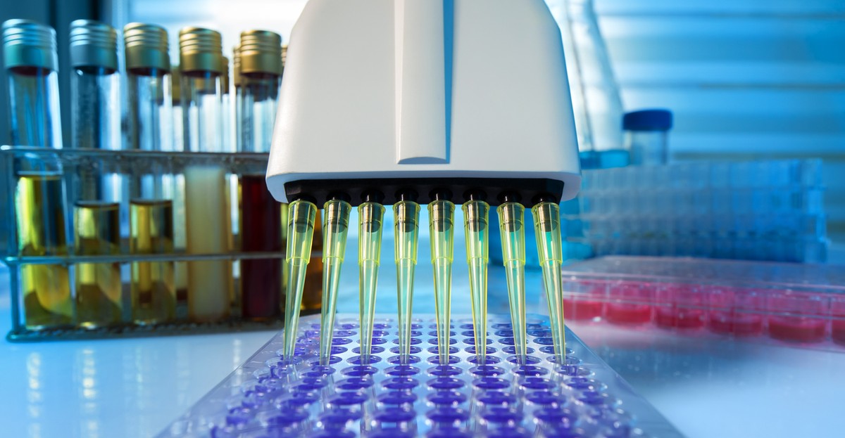 Test ELISA - na czym polega, kiedy wykonać, ile kosztuje? Test ELISA - na czym polega, kiedy wykonać, ile kosztuje?