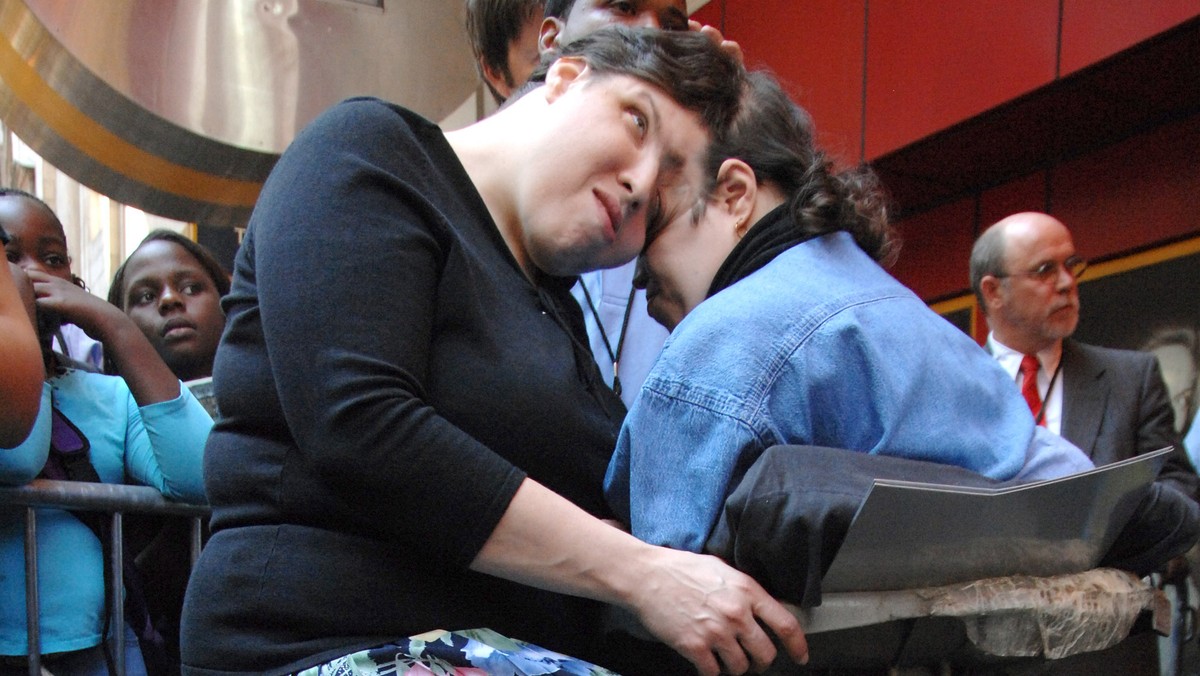 To najstarsze bliźnięta syjamskie na świecie. Tak wygląda ich życie ...