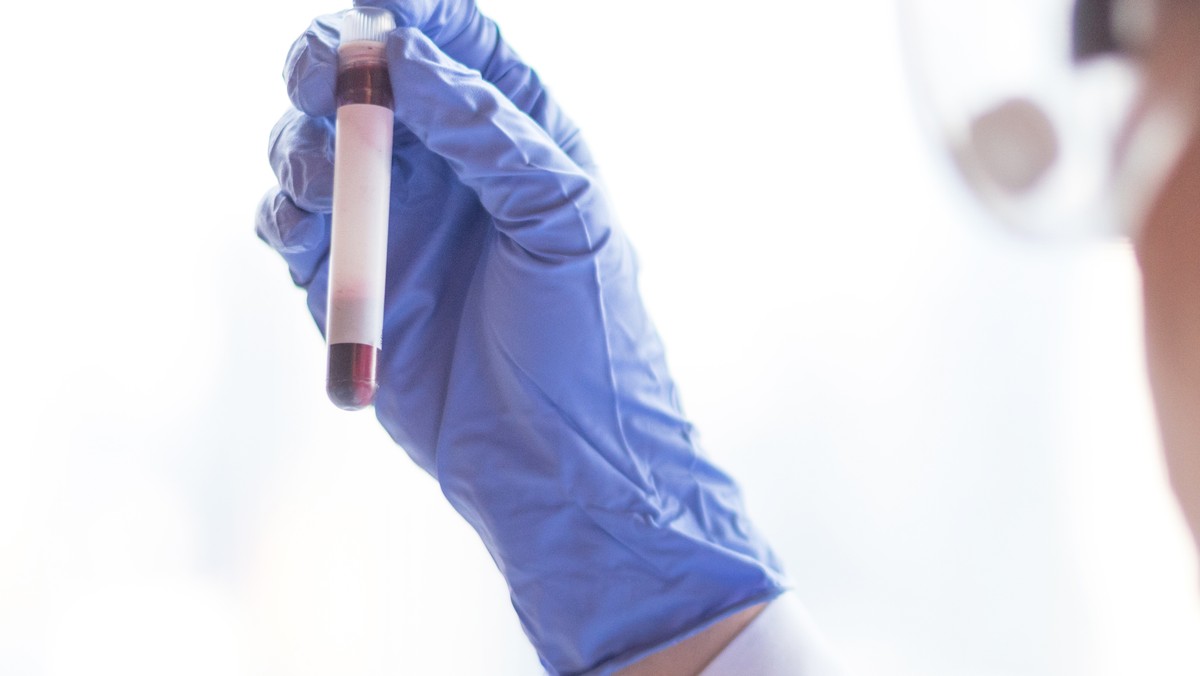 Bazofile – jakie funkcje pełnią? - Zdrowie