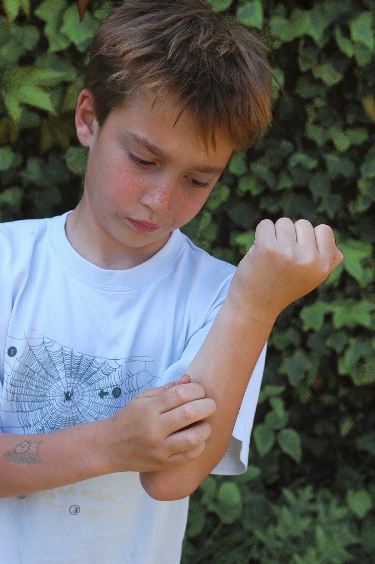 dece prave rane na koži - Žena.rs