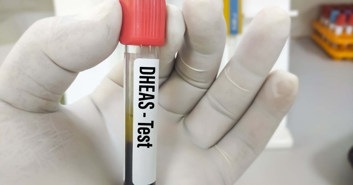 DHEA-SO4 - badanie, normy, wskazania, przebieg i korzyści z wykonania ...