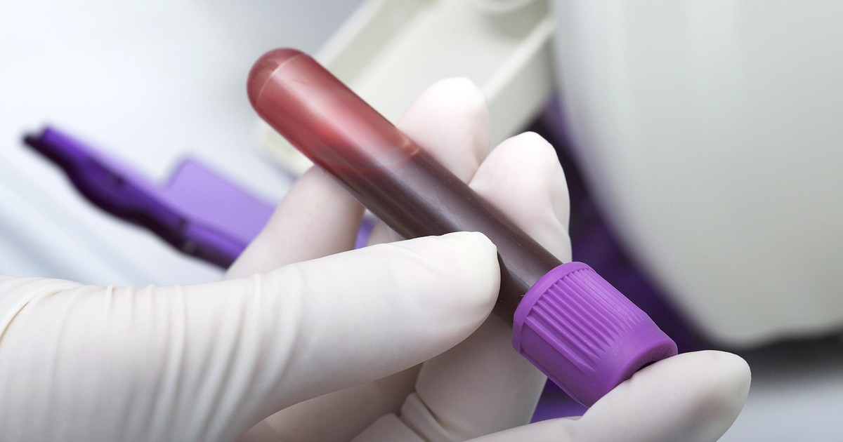 Lipaza - enzym produkowany przez trzustkę. Kiedy wykonać badanie na ...