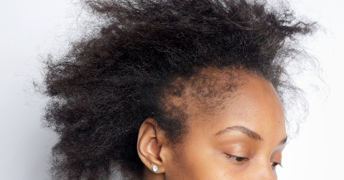 5 things that damage the hair and hairline of African women | Pulse Nigeria
