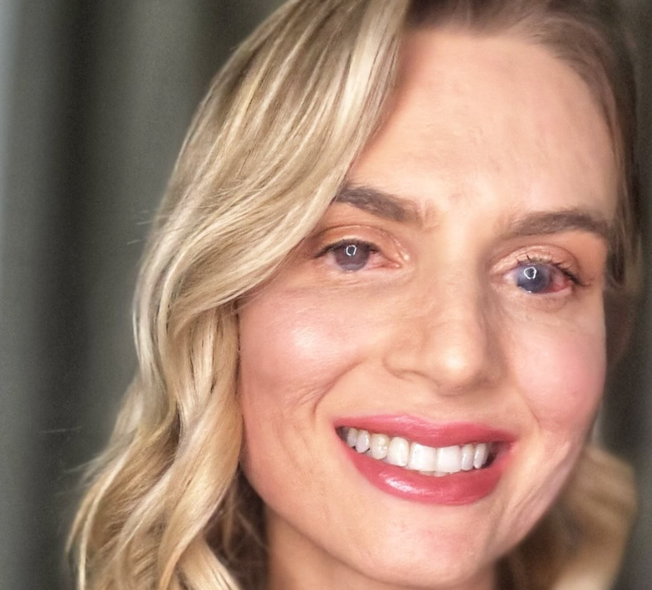 Žena iz Brazila popila lek protiv bolova pa završila 17 dana u komi - Blic