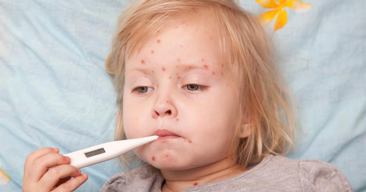 Bostonka u dzieci. Sposoby na zapobieganie tej chorobie są dziecinnie ...