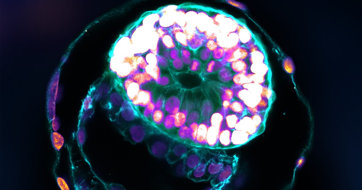 A human embryo grown in a lab without a sperm or egg could be a ...