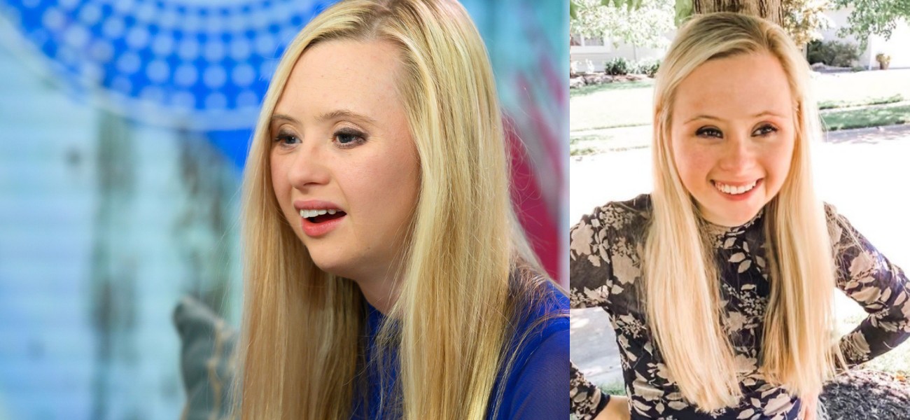 Grace Strobel - modelka z zespołem Downa została gwiazdą branży beauty