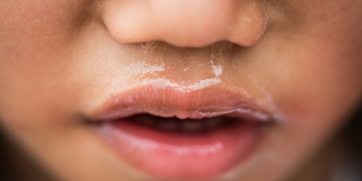 Polipy w nosie – objawy i przyczyny - Zdrowie