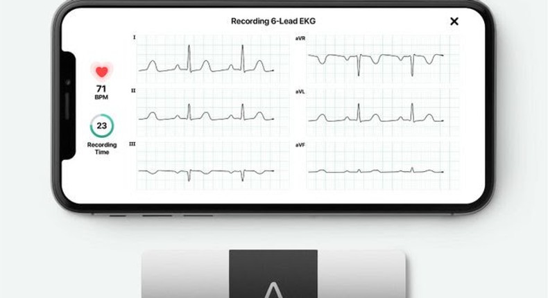 Mobile EKG maker AliveCor has cut ties with Apple amid rising tensions ...
