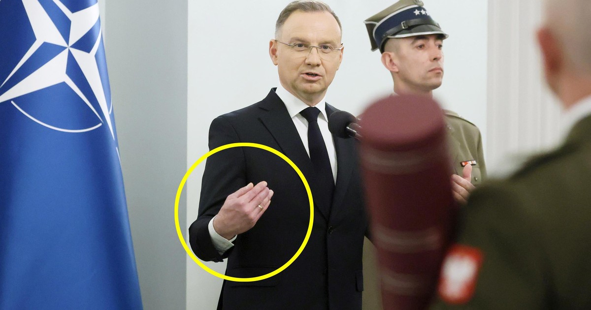 Andrzej Duda stracił kawałek palca. Wojciech Kolarski mówił o kontuzji