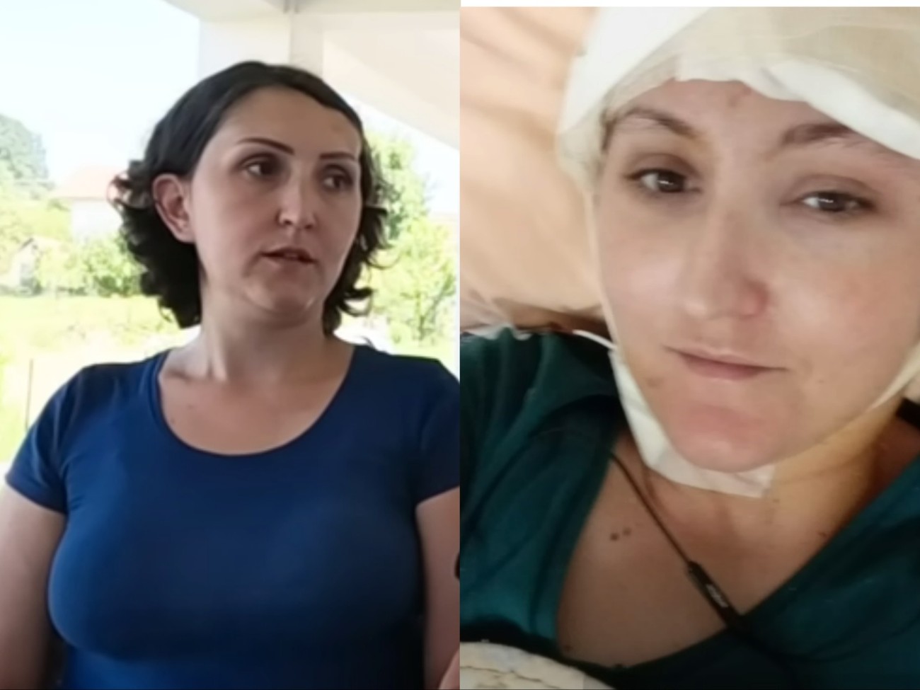 Ispovest Dijane Popović Koja Je Pretrpela Nasilje Prvi šamar Sam Dobila Pred Svadbu Blic