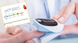 Prawidłowy puls - normy, wysoki i niski puls. Jak zmierzyć puls?