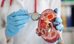 Klirens kreatyniny - wskazania, normy i interpretacja. Czym jest ...