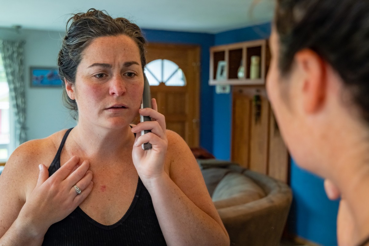 Bőr alatti csomó, dudor: így néz ki a laphámrák és a basalioma ...