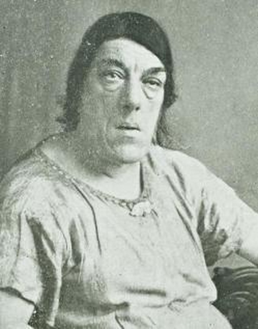 Mary Ann Bevan, najbrzydsza kobieta