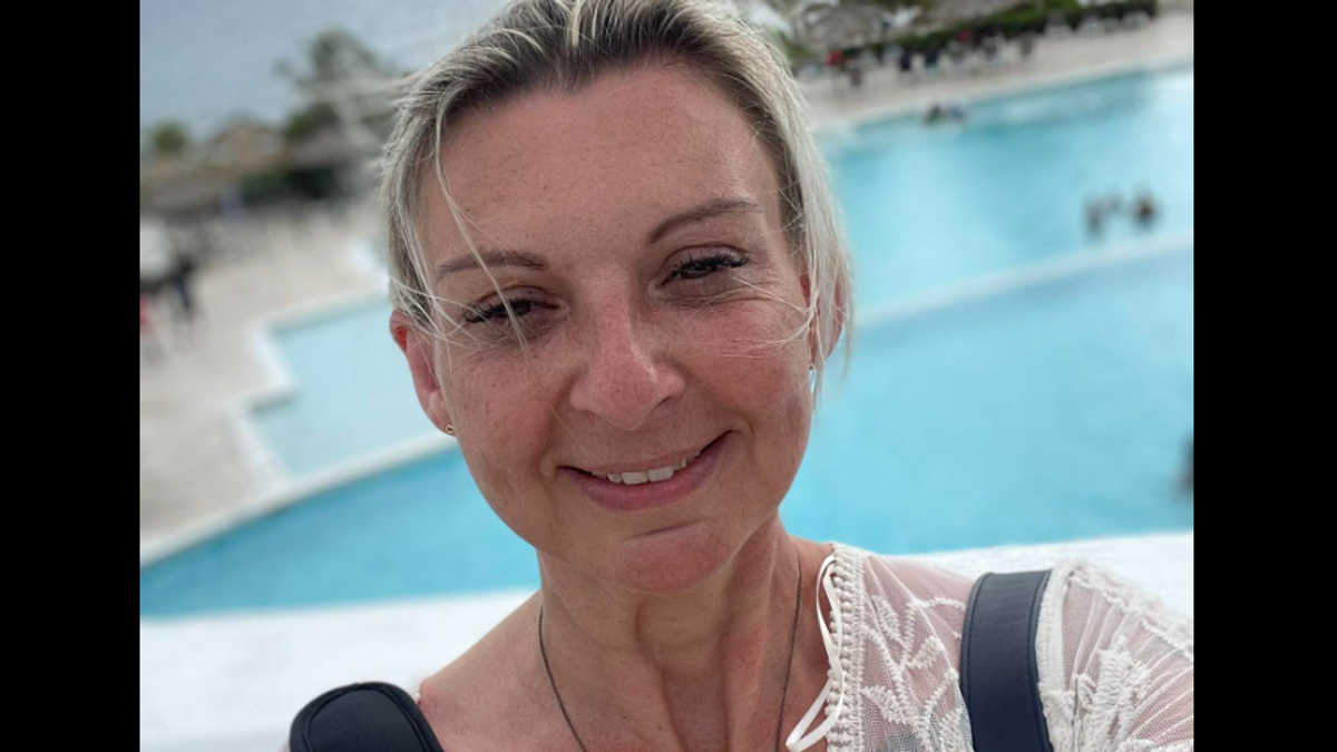 Operisala se u Turskoj za 8.000 evra, pa gorko zažalila: "Bojim se da ću se raspasti" - Blic