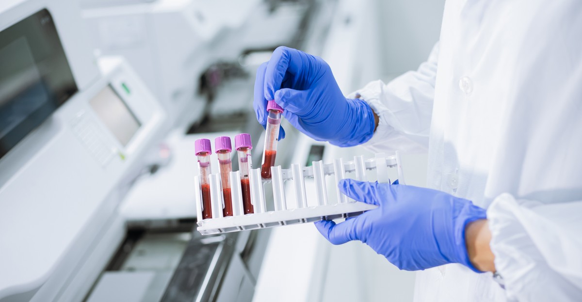 O czym świadczą bazofile podwyższone u dziecka? Ekspertka uspokaja