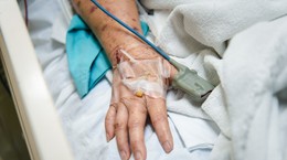 Histiocytoza - przyczyny, objawy, leczenie. Co to za choroba?
