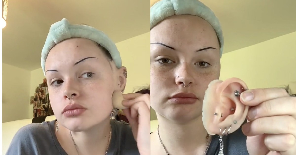 After losing her ear in an accident, a woman showed the daily process ...