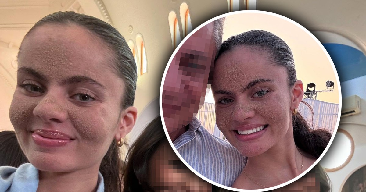 Tia Zakher i kontrowersyjna kuracja jaskiniowa na trądzik. Nie myje twarzy