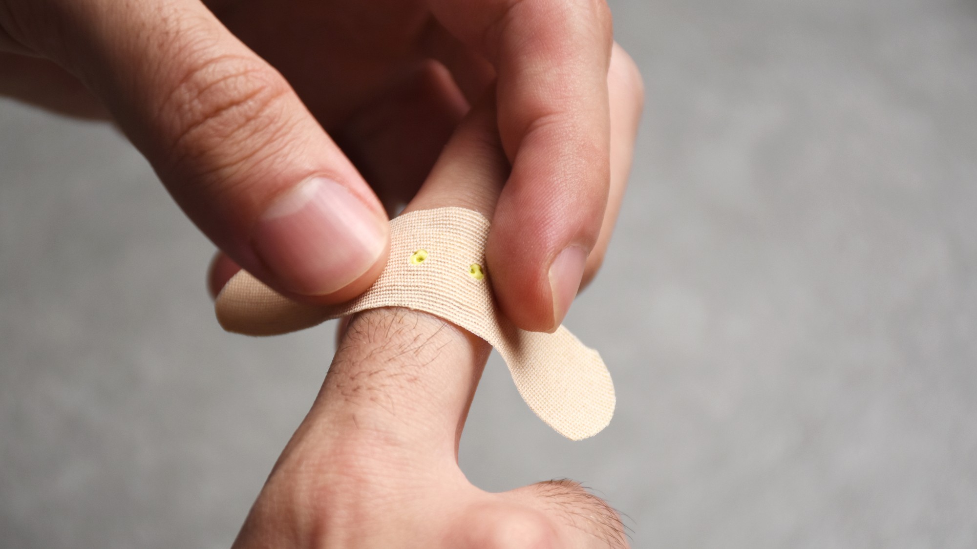 Video zachytávajúce hojenie rany sa stalo hitom internetu: Toto sa deje ...