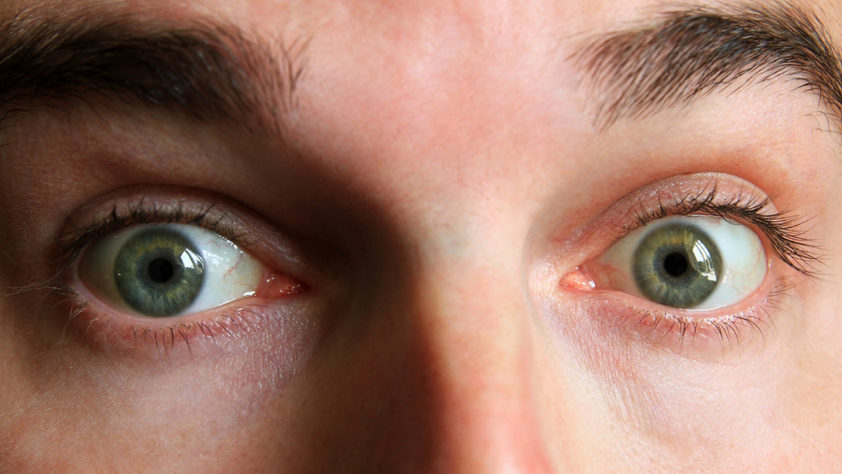 Trypofobia (choroba) - test, przyczyny i objawy. Co to jest - Kobieta