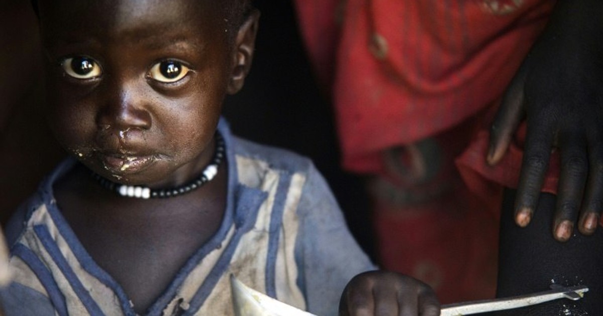 Top 10 African Countries most affected by hunger and malnutrition in ...