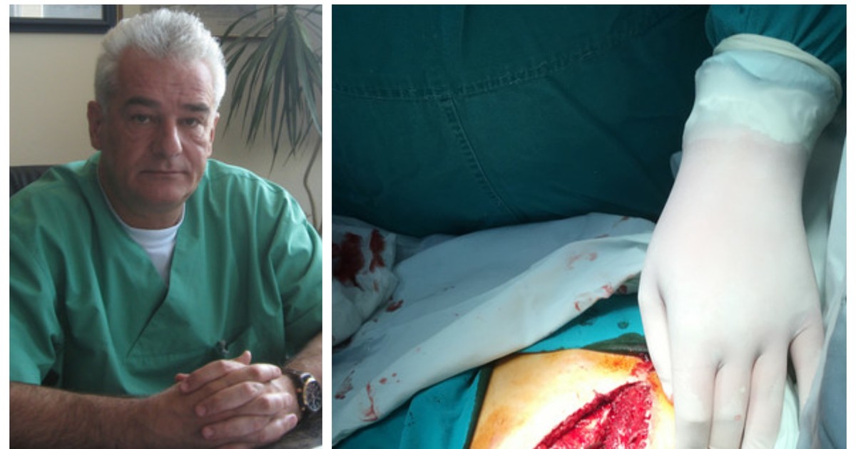 "TESTERA MI JE KIDALA GRUDI, VIDEO SAM SVOJE ORGANE" Drvoseča kome su ...