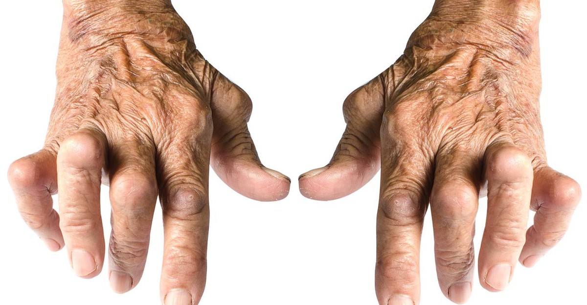 Dicloberl - działanie, przeznaczenie, stosowanie i przeciwwskazania ...