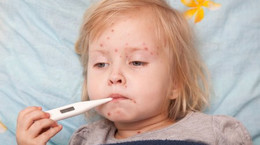 Jak wygląda ospa? Lekarka wyjaśnia objawy