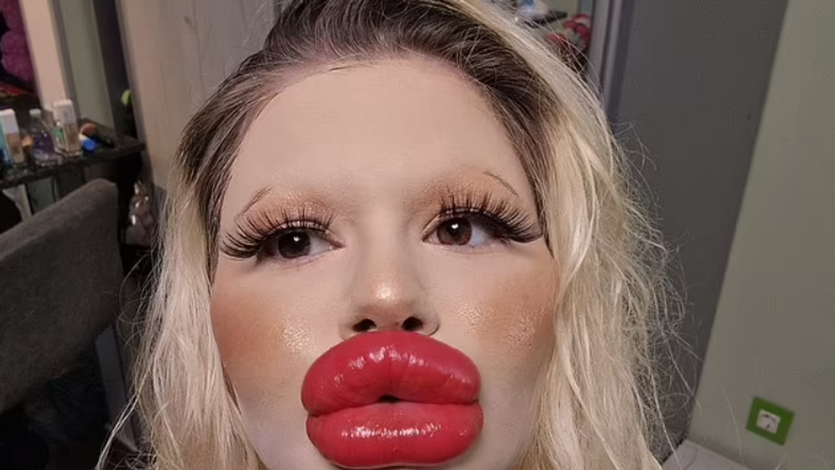 Andrea je devojka sa najvećim usnama na svetu - Blic