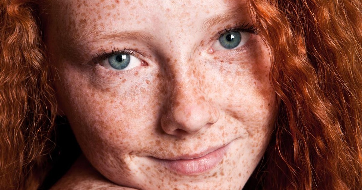 Piegi - dlaczego się pojawiają? Jak wybielić piegi?