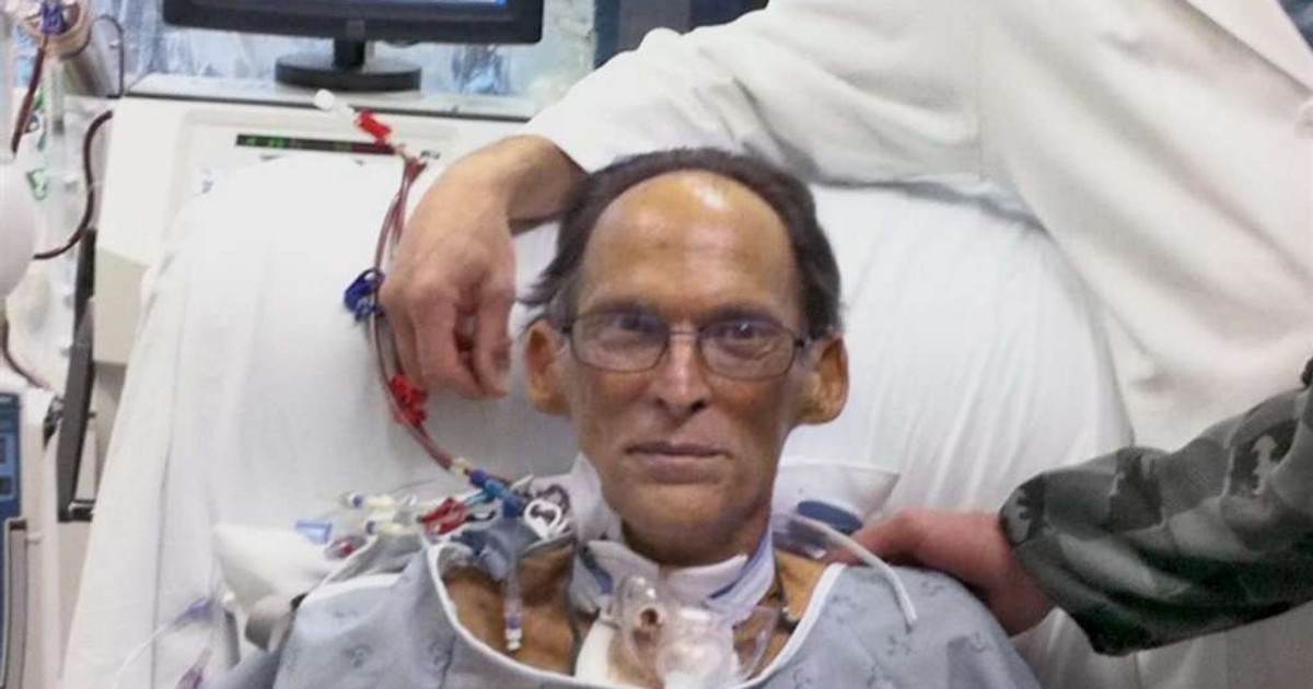 Ten człowiek żyje bez serca