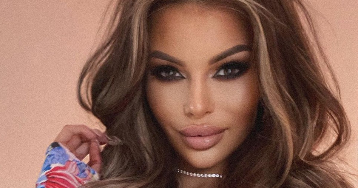 Justyna Gradek przed operacjami. Pokazała stare zdjęcia. Nie do ...