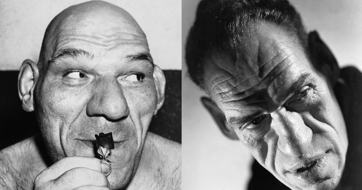 Akromegalia - objawy i diagnostyka. Jak leczyć akromegalię