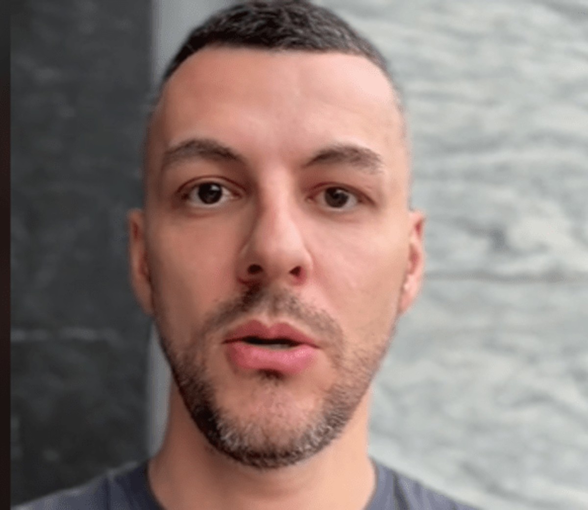 Doktor Dragan pokazao jezivu fotografiju i otkrio šta se desi sa kožom ...