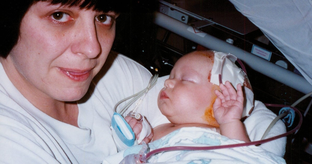 My 4-month-old needed skull surgery. He was born without a soft spot ...